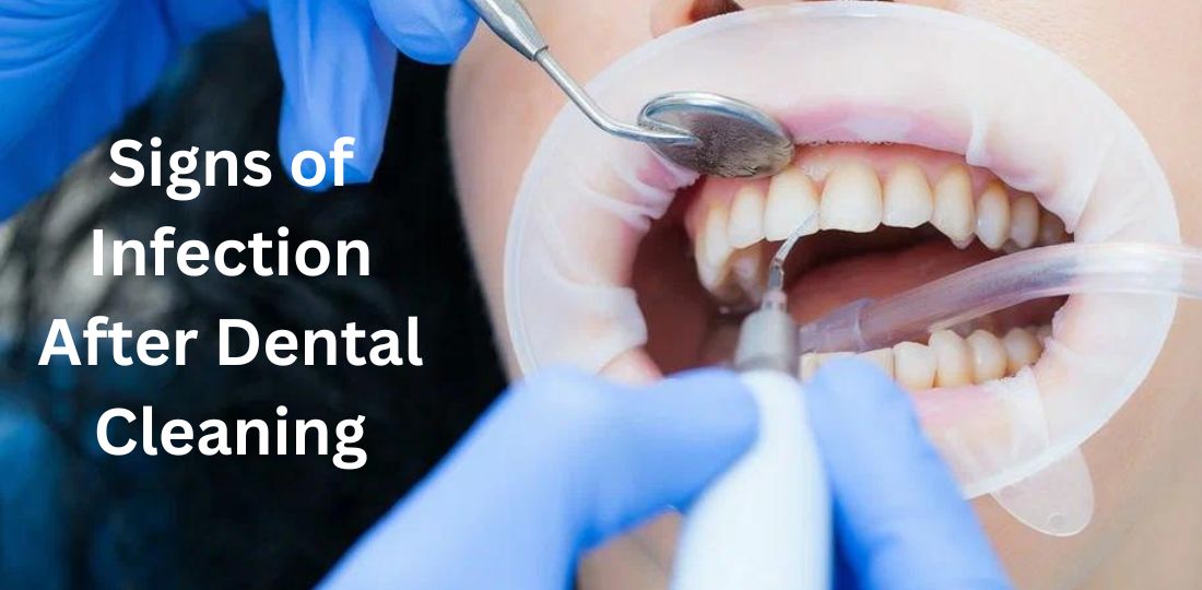 Signs of Infection After Dental Cleaning